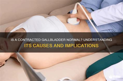 Is A Contracted Gallbladder Normal Understanding Its Causes And Implications Medshun