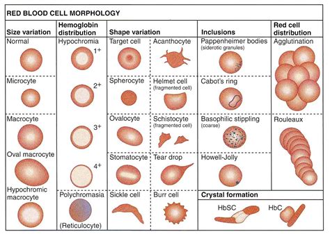 Abnormal Blood Cell Shape Abnormal Red Blood Cell Morphological