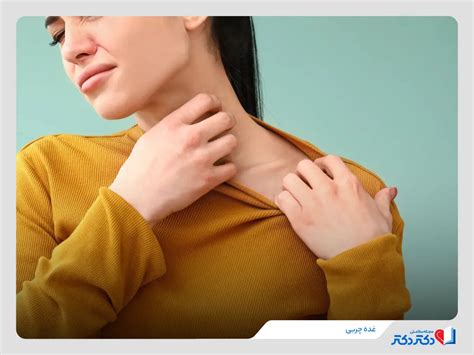 غده چربی چیست؟ راه‌های درمان پزشکی و خانگی صد در صد لیپوم