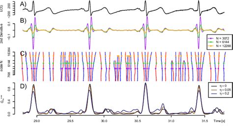 Figure 1 From Removal Of Ecg Artifacts From Emg Signals With Different