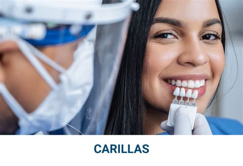 Estética Dental