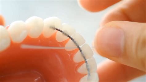 نخ دندان سوپر فلاس دکتر محمد محمدی نماشا