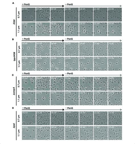Significance Of Outer Membrane Proteins Lpp Ompa And Pal For Download Scientific Diagram