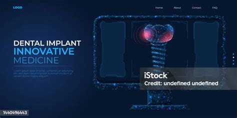 치과 임플란트의 디지털 3d 로우 폴리 모델 건강한 치아 구강 위생 치과 치료의 와이어 프레임 개념 추상적인 배경 벡터 그림입니다 3차원 형태에 대한 스톡 벡터 아트 및