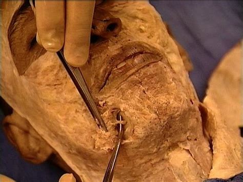 face temporal and infratemporal fossae lab exam flashcards quizlet