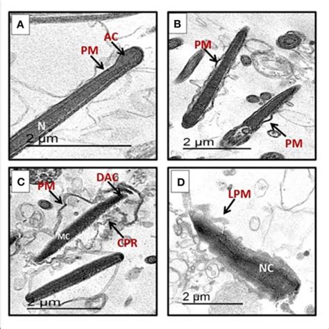 Transmission Electron Microscope Tem Micrographs Of Ram Spermatozoa