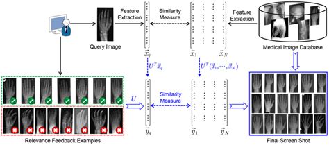 Relevance Feedback Based Medical Image Retrieval Framework Download