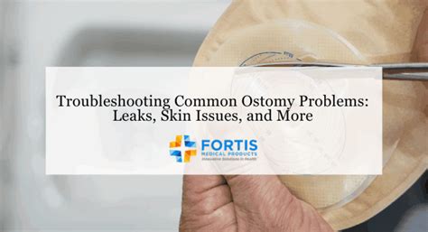 Troubleshooting Common Ostomy Problems Skin Barrier Rings