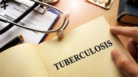 Its Not Me Its Us The Importance Of Peer Support Groups In Tuberculosis Tb Management