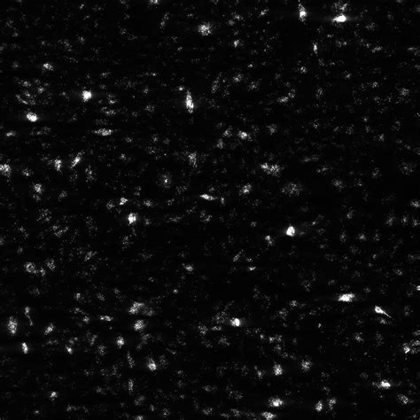 Rna Scope Imaging And Quantification Image Analysis Imagesc Forum Rna Scope Imaging And Quantification Image Analysis Imagesc Forum