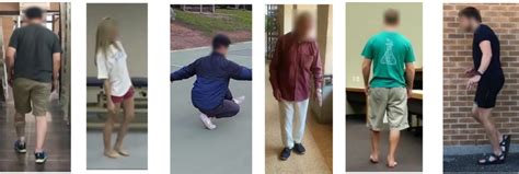 [논문 리뷰] Computer Vision For Clinical Gait Analysis A Gait Abnormality Video Dataset