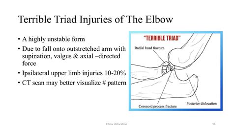 Management Of Elbow Fracture Dislocation Pptx