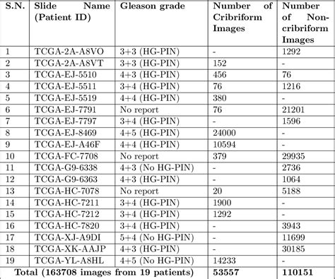 Cribriform Pattern Detection In Prostate Histopathological Images Using