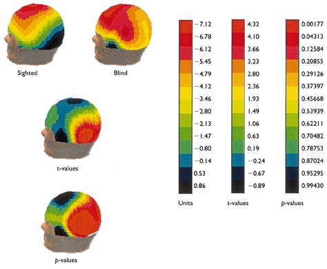 Scalp Distribution Of The N1 Component Top Topographical Maps Of The Download Scientific