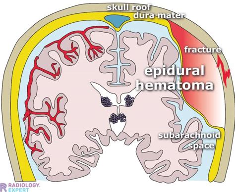 Subarachnoid Space