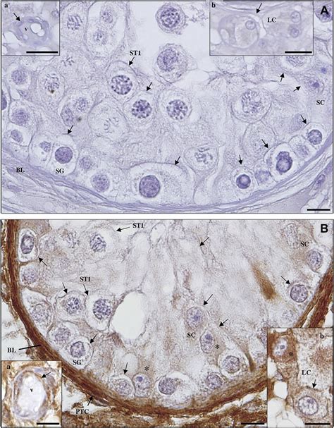 Detection Of Angiotensin Converting Enzyme 2 Protein In Maturation