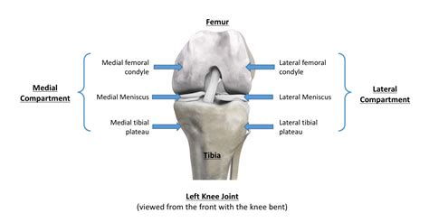 Knee Femoral Condyles