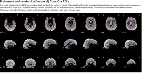 Negative Data Following Multi Echo Optimal Combination In Fmriprep