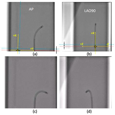 Use Of Yolo Detection For 3d Pose Tracking Of Cardiac Catheters Using Bi Plane Fluoroscopy