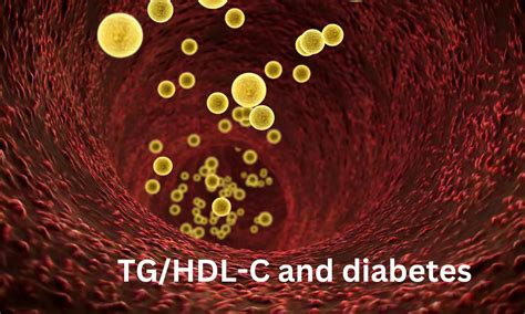 Lowering Tghdl C Ratio Can Prevent Prediabetes And Type 2 Diabetes