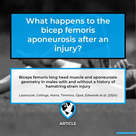 Hamstring Strain Injuries Hsis Commonly Affect The Proximal Biceps