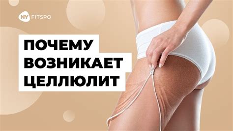 Почему возникает целлюлит Школа здорового фитнеса Youtube