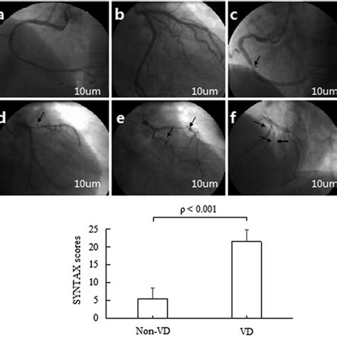 Syntax Scores In Different Groups Upper Row Shows Representative