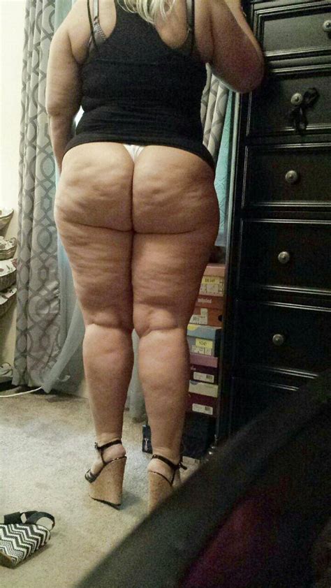 A Lady Standing Up In Her Room Has Cellulite On Her Thighs And Butt