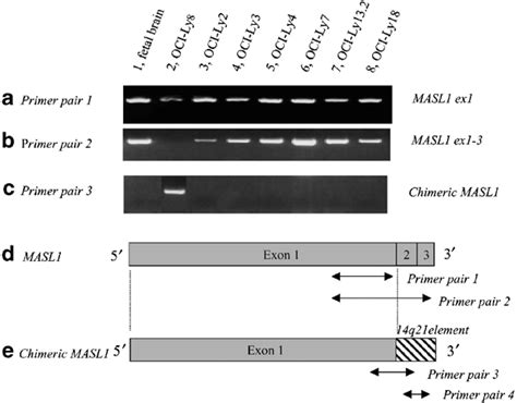 Rtpcr Analysis And Normal And Chimeric Masl1 Cdnas Lane 1 Fetal