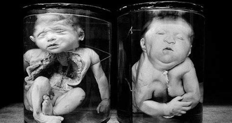 Crispr Cracks Open The Door To A Future Of Human Mutants Worried