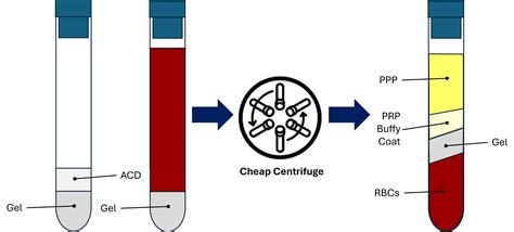 The Great Prp Gel Tube Caper Regenexx Platohealth