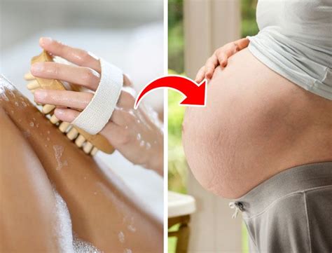 Ways To Make Your Stretch Marks Less Visible Bright Side
