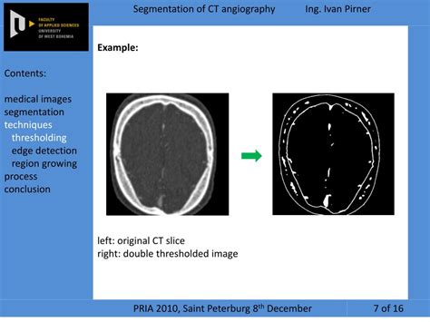 ppt segmentation of ct a ng iography based on a combination of