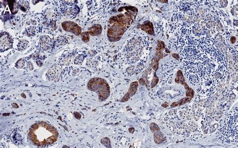 Hek 293t Atcc Sigma Aldrich