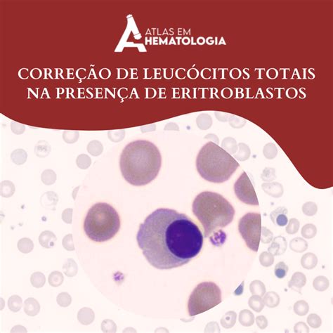 CorreÇÃo De LeucÓcitos Totais Na PresenÇa De Eritroblastos Atlas Em