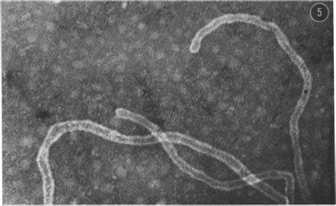 Cellular Projections × 200000 Download Scientific Diagram