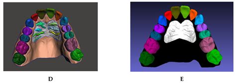 Three Dimensional Semantic Segmentation Of Palatal Rugae And Maxillary Teeth And Motion