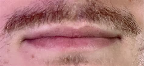 Lip Wikipedia