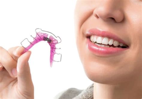 Invisalign Attachments Roberto Macedo Dds Ms Phd Invisalign Attachments Roberto Macedo Dds Ms Phd