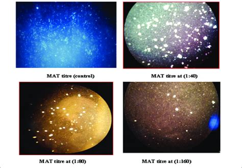Showing Agglutination At Different Mat Titre Of The Positive Samples Download Scientific Diagram