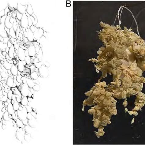 Conjoined Twins A Specimen 4070 913 Dicephalus Tribrachius Dipus Download Scientific