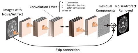 Review Noise And Artifact Reduction For Mri Using Deep Learning Deepai