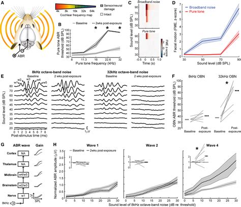 Sound Elicits Stereotyped Facial Movements That Provide A Sensitive