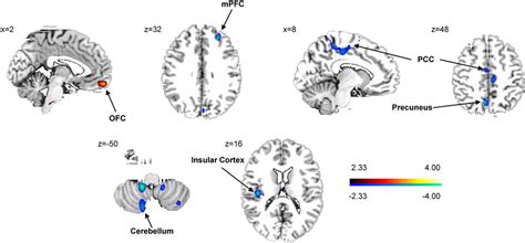 Motor Learning Related Spatial Covariance Pattern In Subjects With