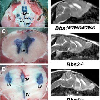 PDF Structural Defects In Cilia Of The Choroid Plexus Subfornical Organ And Ventricular