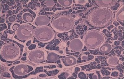 Research Proves Gender Bending Chemicals Af EurekAlert