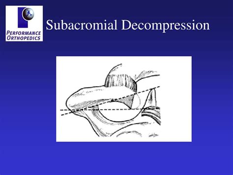 Ppt Beaumont Doctors Specializing In Sports Medicine Powerpoint