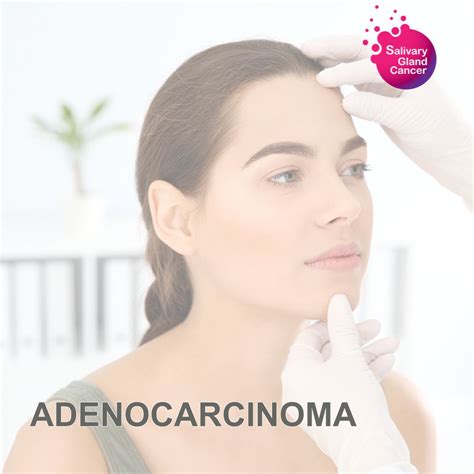 Acinic Cell Carcinoma Accc Salivary Gland Cancer Uk