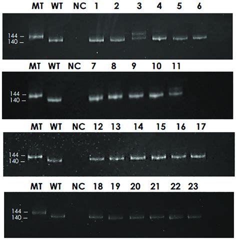 Detecting Npm1 Gene Mutations In Patient Samples Using A Standard Pcr