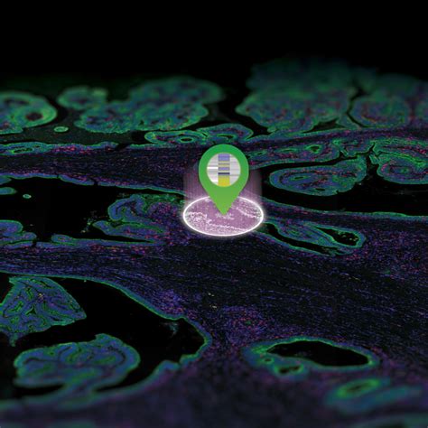 GeoMx DSP Archives NanoString